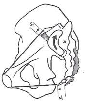 Pelvis and Sacro Iliac Joint - Alex Tiemes 3DMT